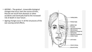 AGE RELATED CHANGES IN EYE(Eyelids, Conjunctiva, cornea, iris, pupil ...