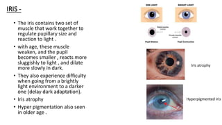 AGE RELATED CHANGES IN EYE(Eyelids, Conjunctiva, cornea, iris, pupil ...