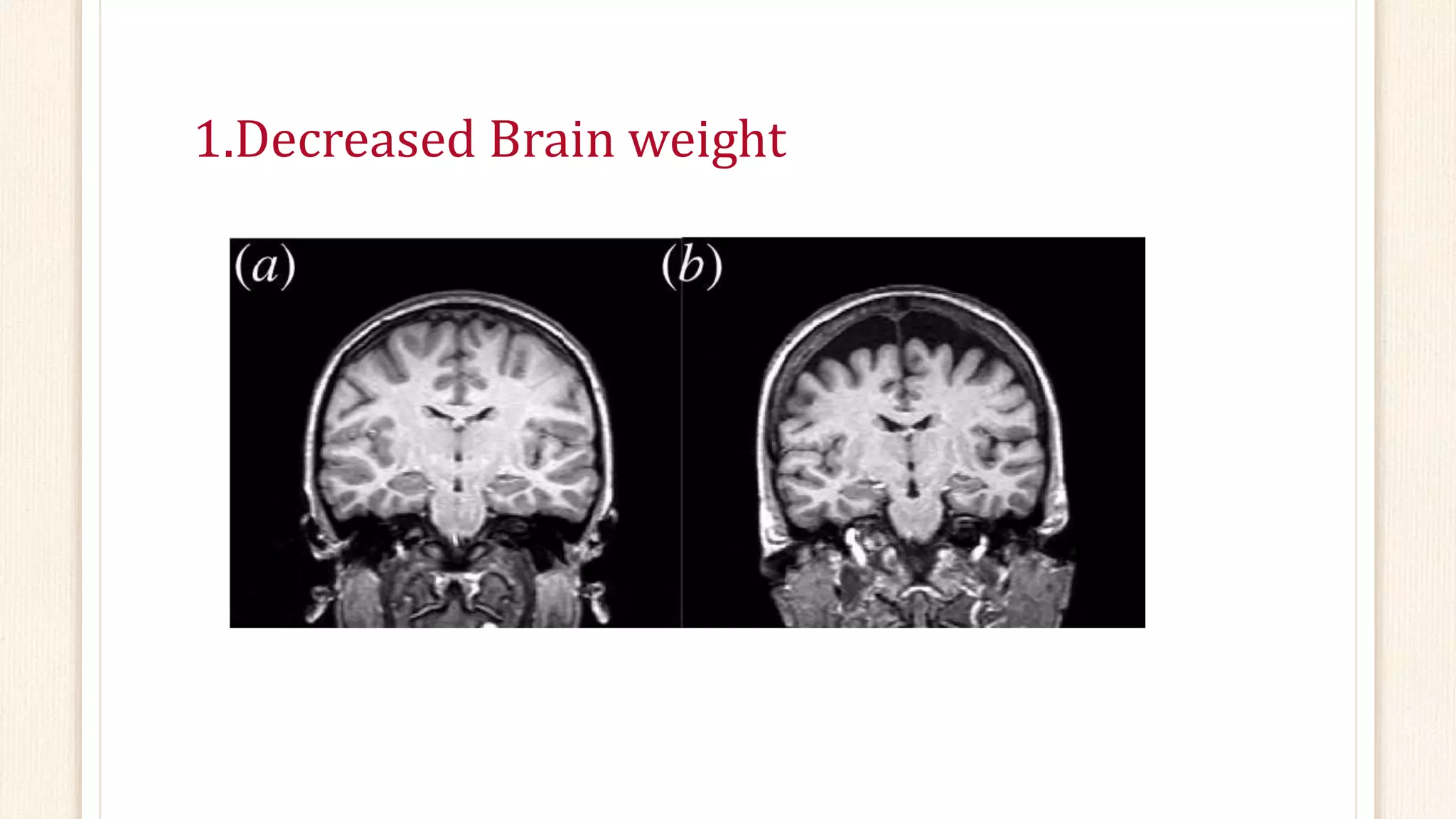 Age related changes in nervous system | PPTX