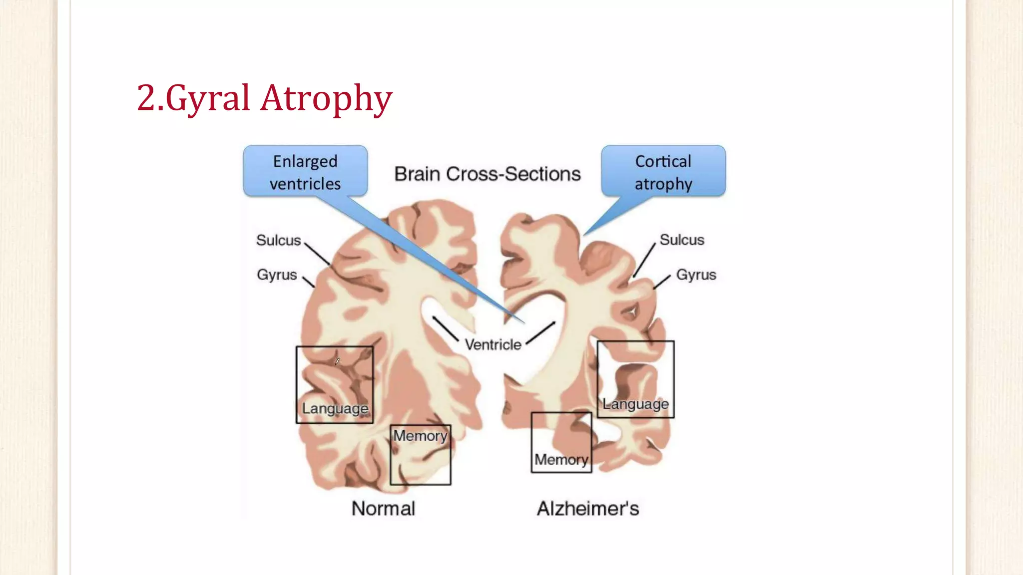 Age related changes in nervous system | PPTX