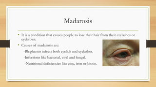 Age related disease in ocular adnexa | PDF