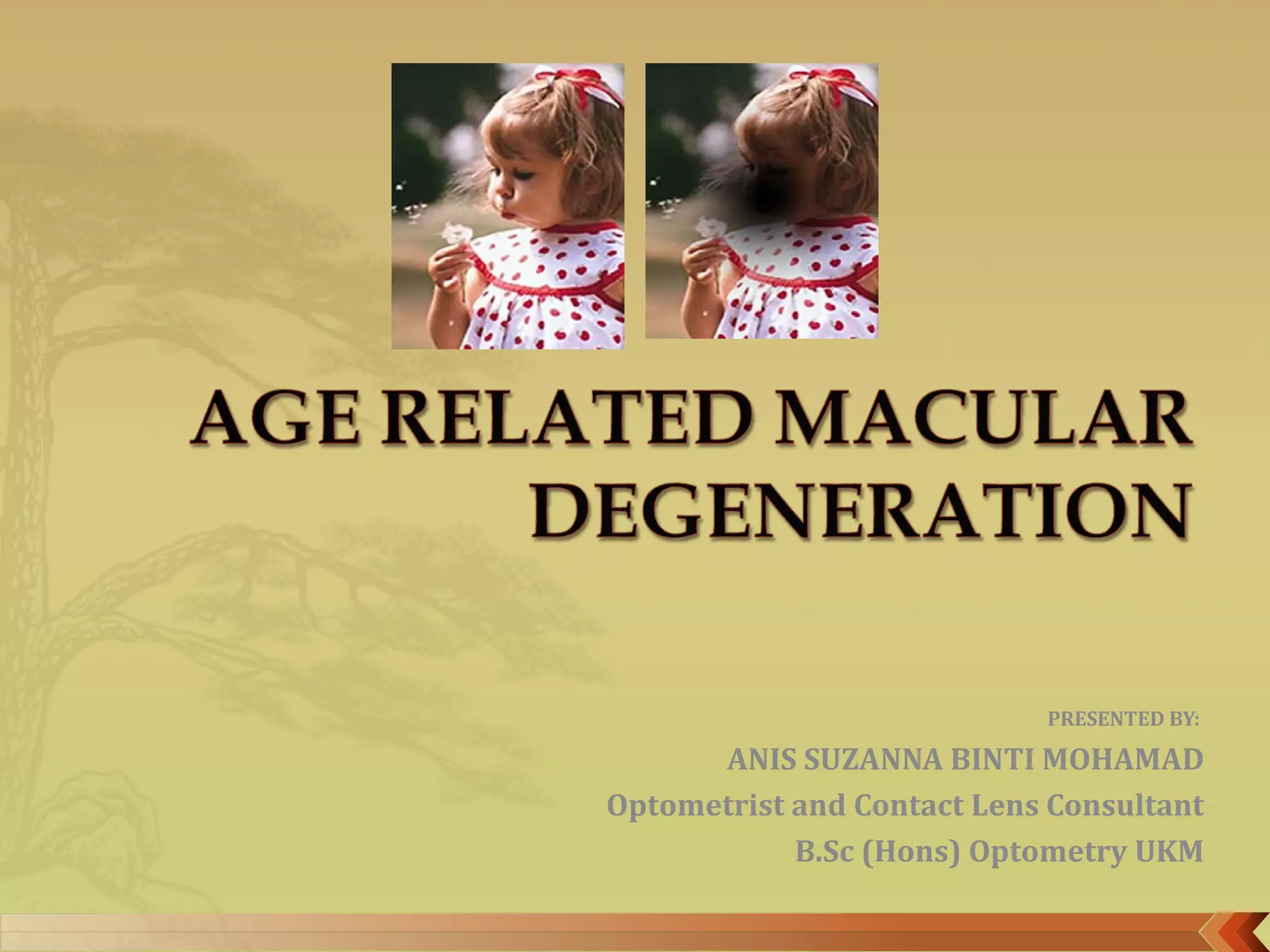 Age related macular degeneration from Optometrist Point of View | PPT