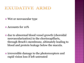 Age related macular degeneration | PPTX