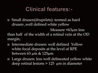 Age related macular degeneration | PPTX