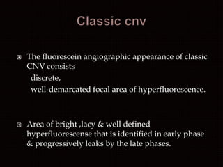 Age related macular degeneration | PPTX