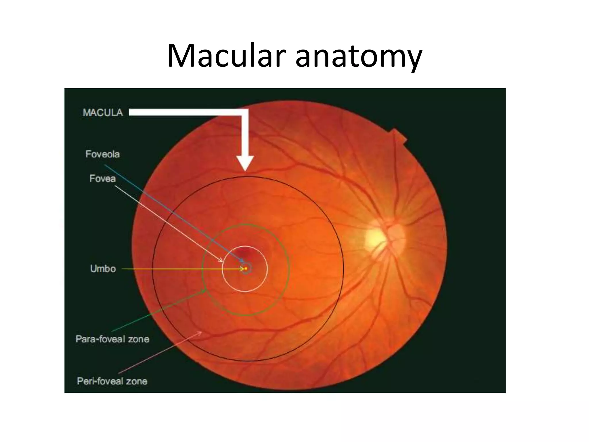 Age related macular degeneration | PPTX