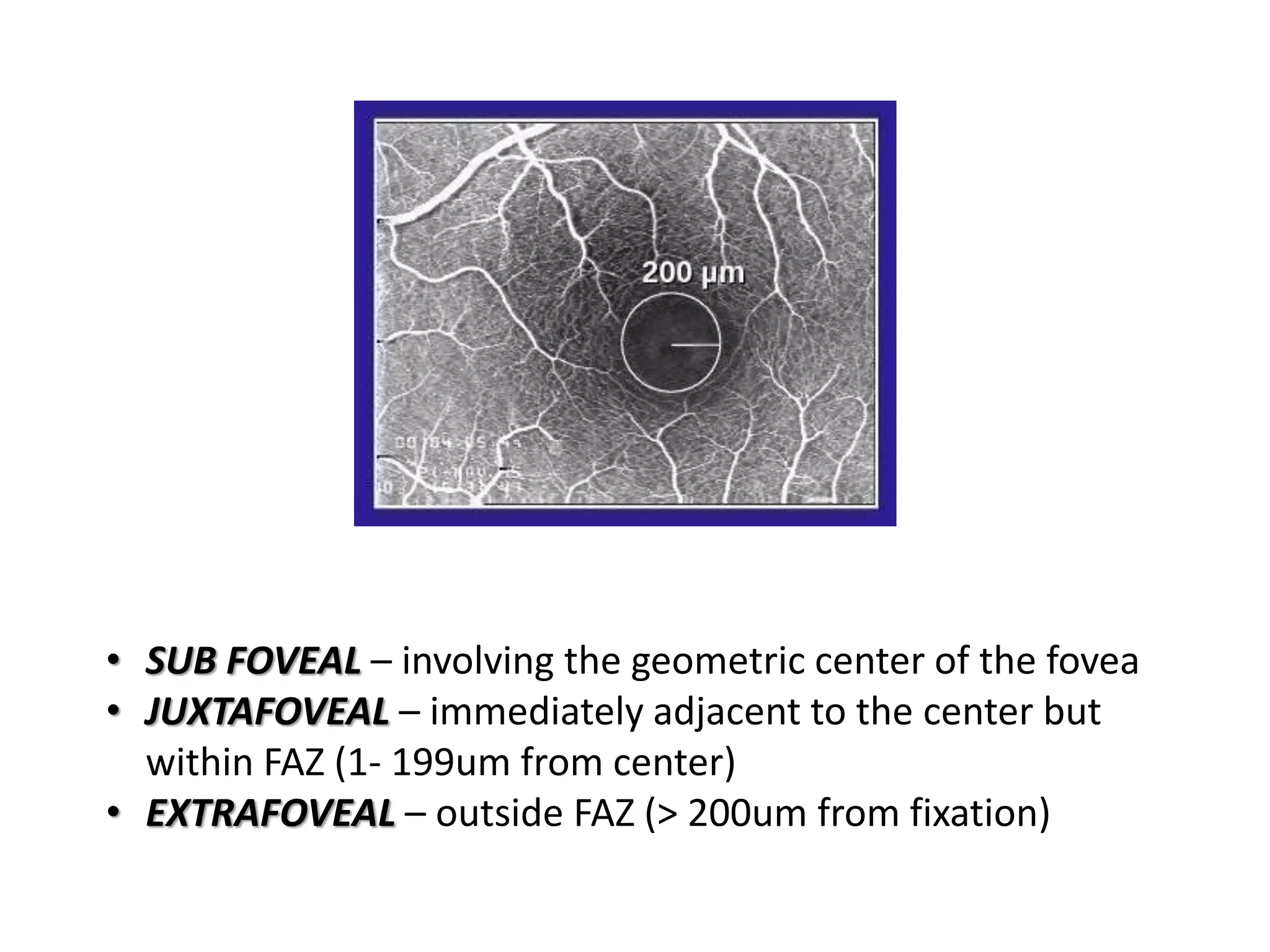 Age related macular degeneration | PPTX