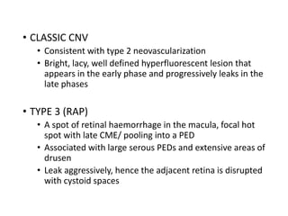 Age related macular degeneration | PPTX