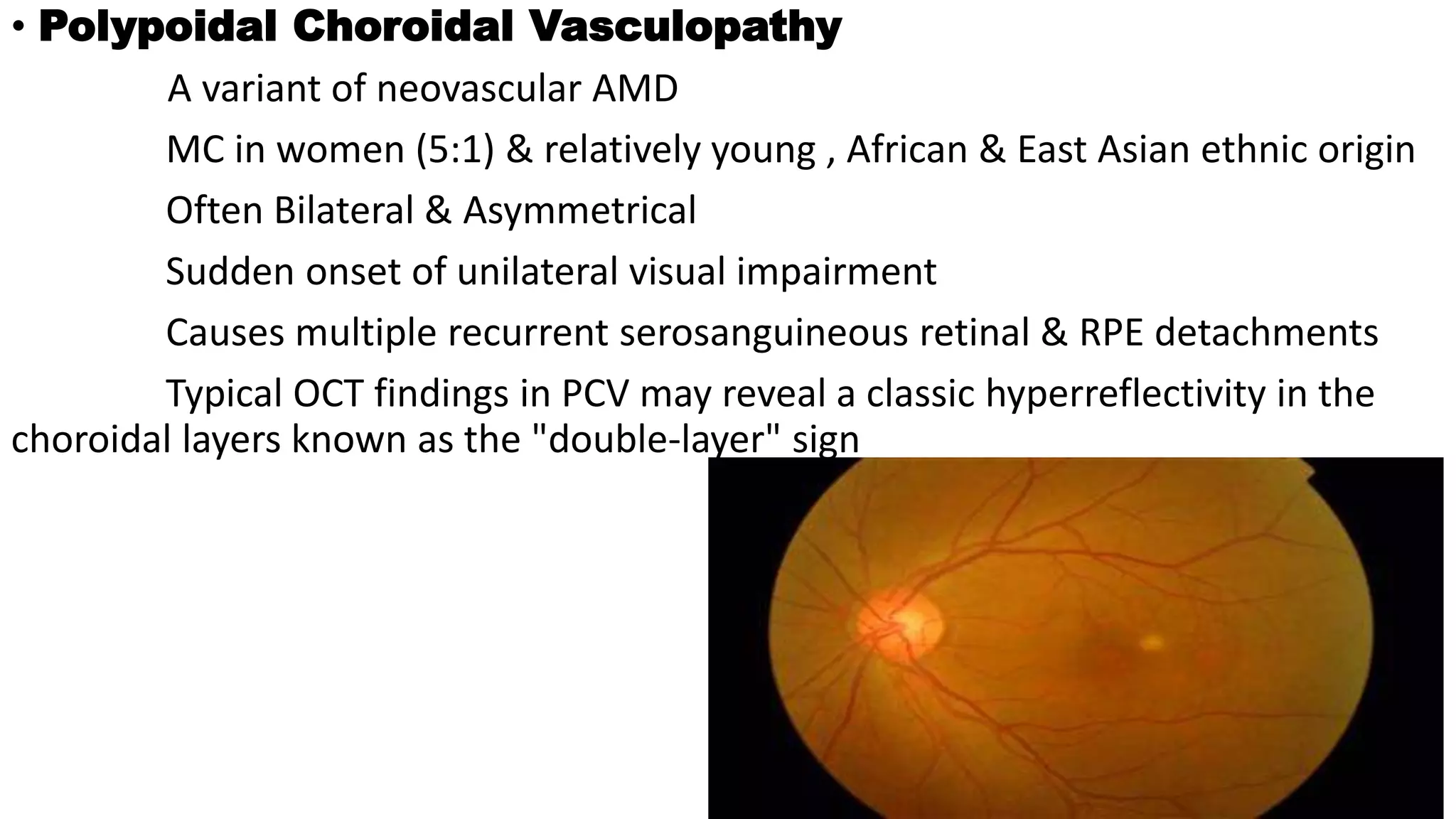 Age related macular degeneration nitin | PPTX