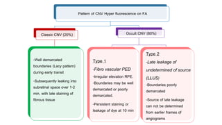 Age related macular degeneration nitin | PPTX
