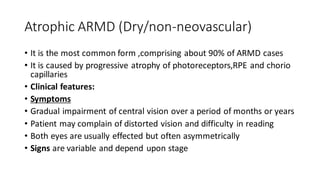 AGE RELATED MACULAR DEGRNERATION(ARMD).pdf
