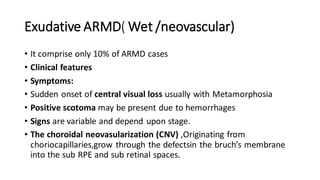 AGE RELATED MACULAR DEGRNERATION(ARMD).pdf