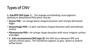AGE RELATED MACULAR DEGRNERATION(ARMD).pdf