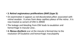 AGE RELATED MACULAR DEGRNERATION(ARMD).pdf