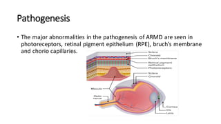 AGE RELATED MACULAR DEGRNERATION(ARMD).pdf