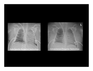 Agfa dose management for image quality | PDF