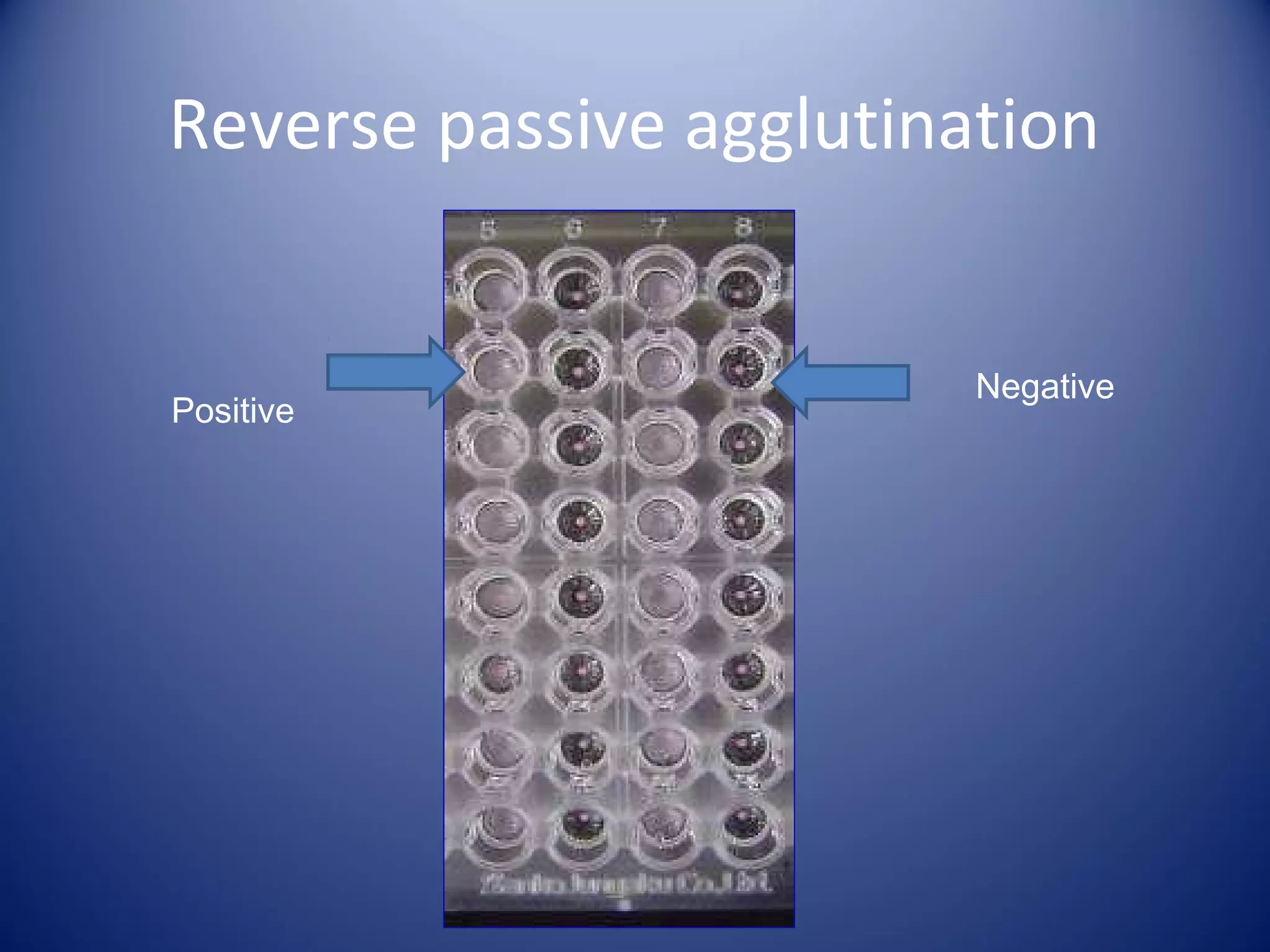 Agglutination | PPT