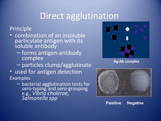Slide Agglutination Test Procedure