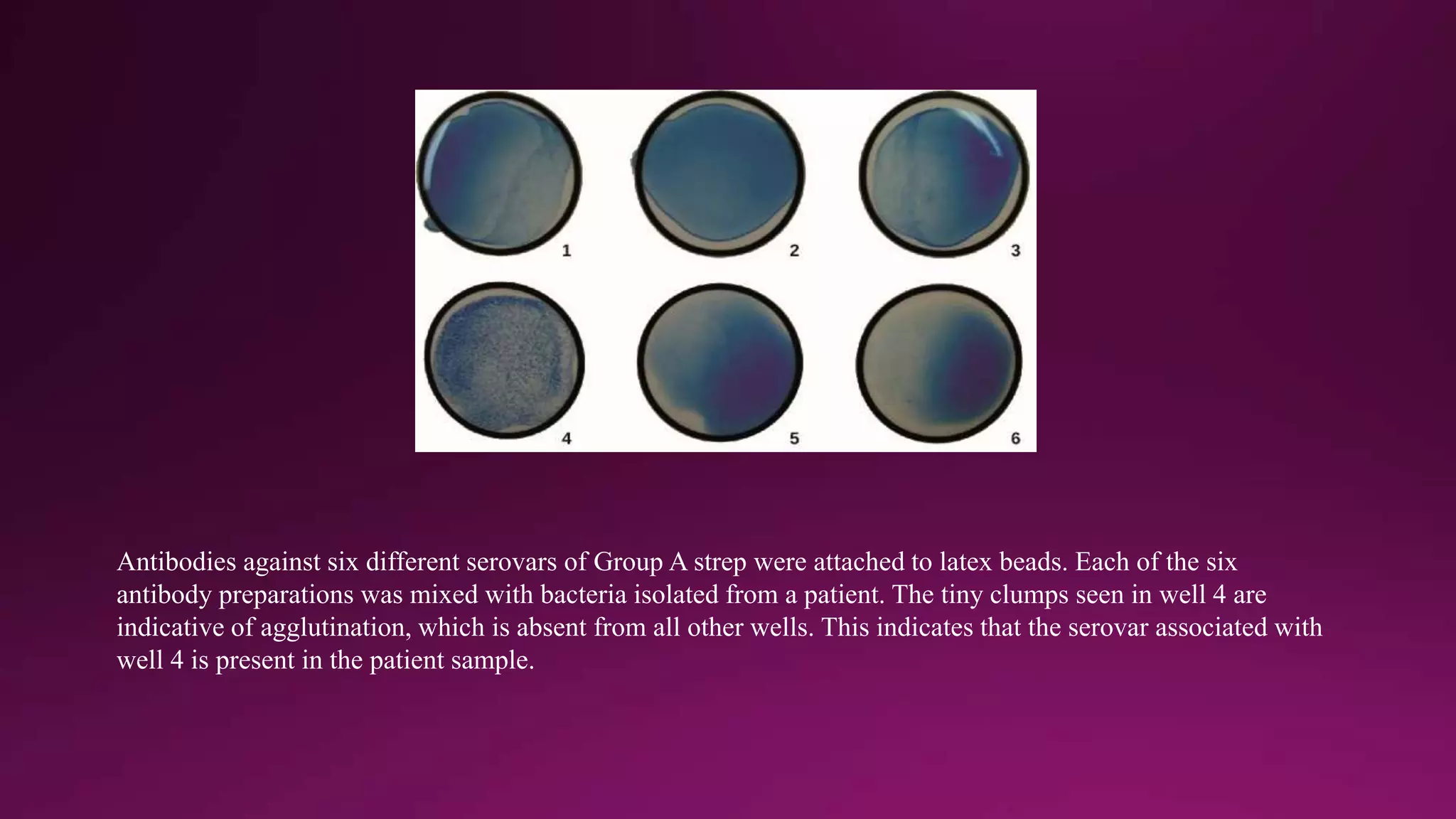 Agglutination | PPTX