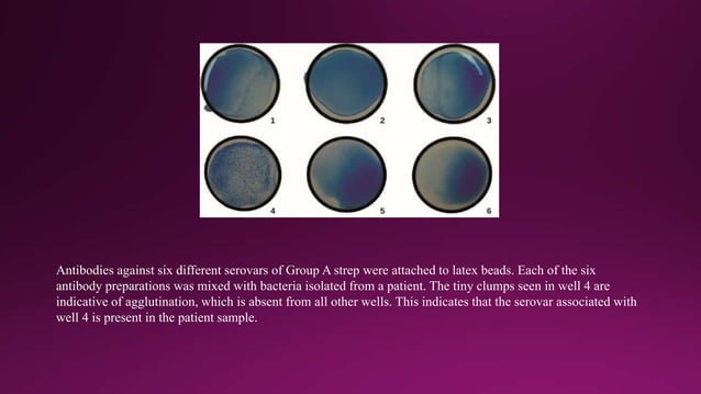 Agglutination | PPT