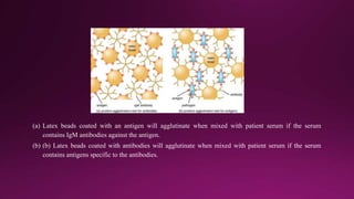 Agglutination | PPTX
