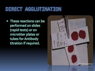 Direct Hemagglutination