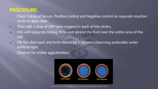 Agglutination reactions: Types, Examples, Advantages, disadvantages ...