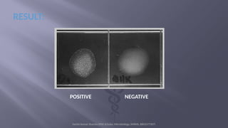 Agglutination reactions: Types, Examples, Advantages, disadvantages ...