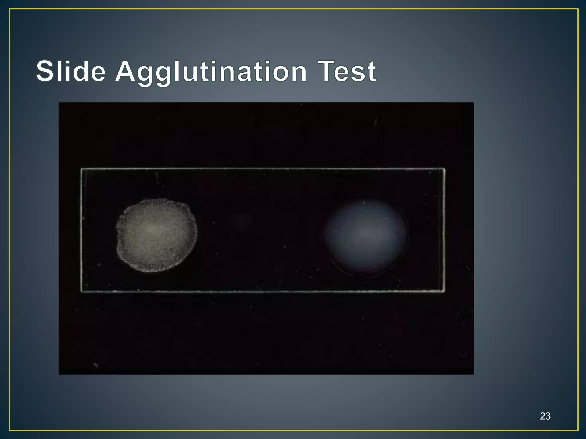 Agglutination test ,antigen antibody reaction | PPTX