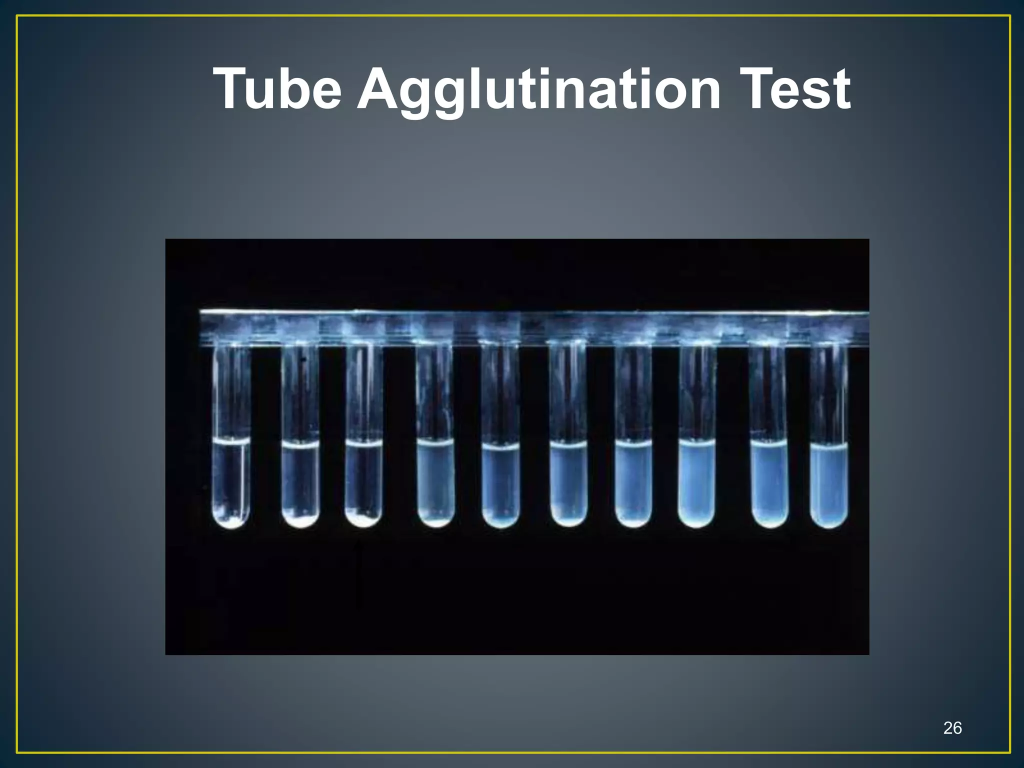 Agglutination test ,antigen antibody reaction | PPTX