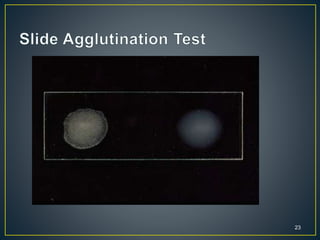 Agglutination test ,antigen antibody reaction | PPTX