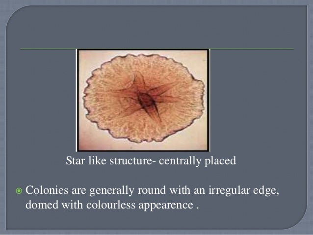 Aggregatibacter actinomycetemcomitans
