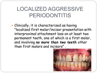 Aggresive periodontitis | PPTX