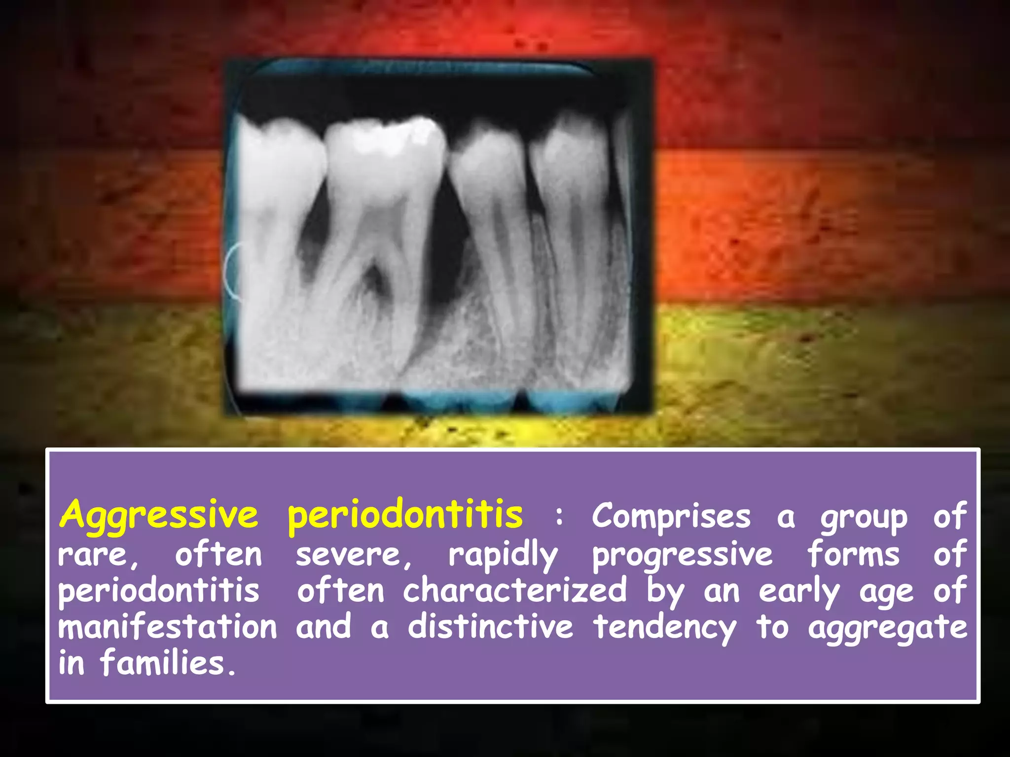 Aggressive-Periodontitis-1-202110221533460.pptx