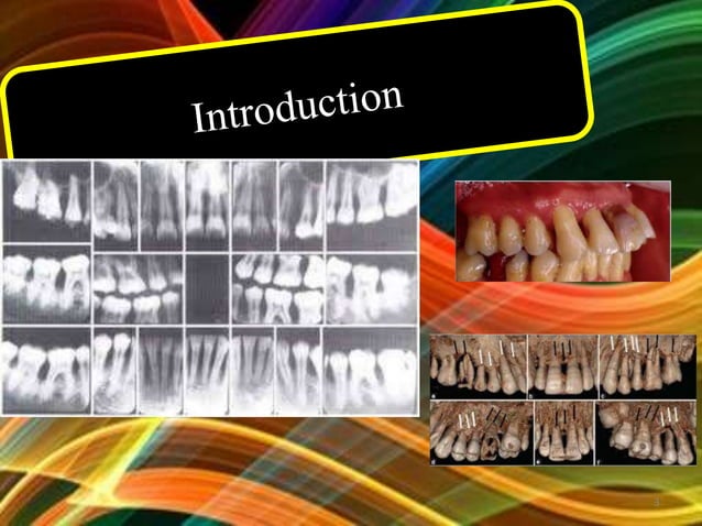 Aggressive-Periodontitis-1-202110221533460.pptx