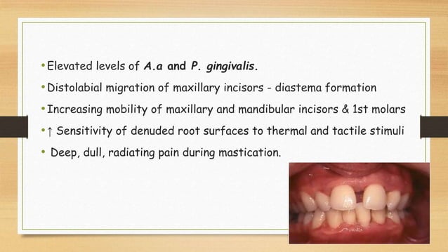 Aggressive periodontitis | PPTX