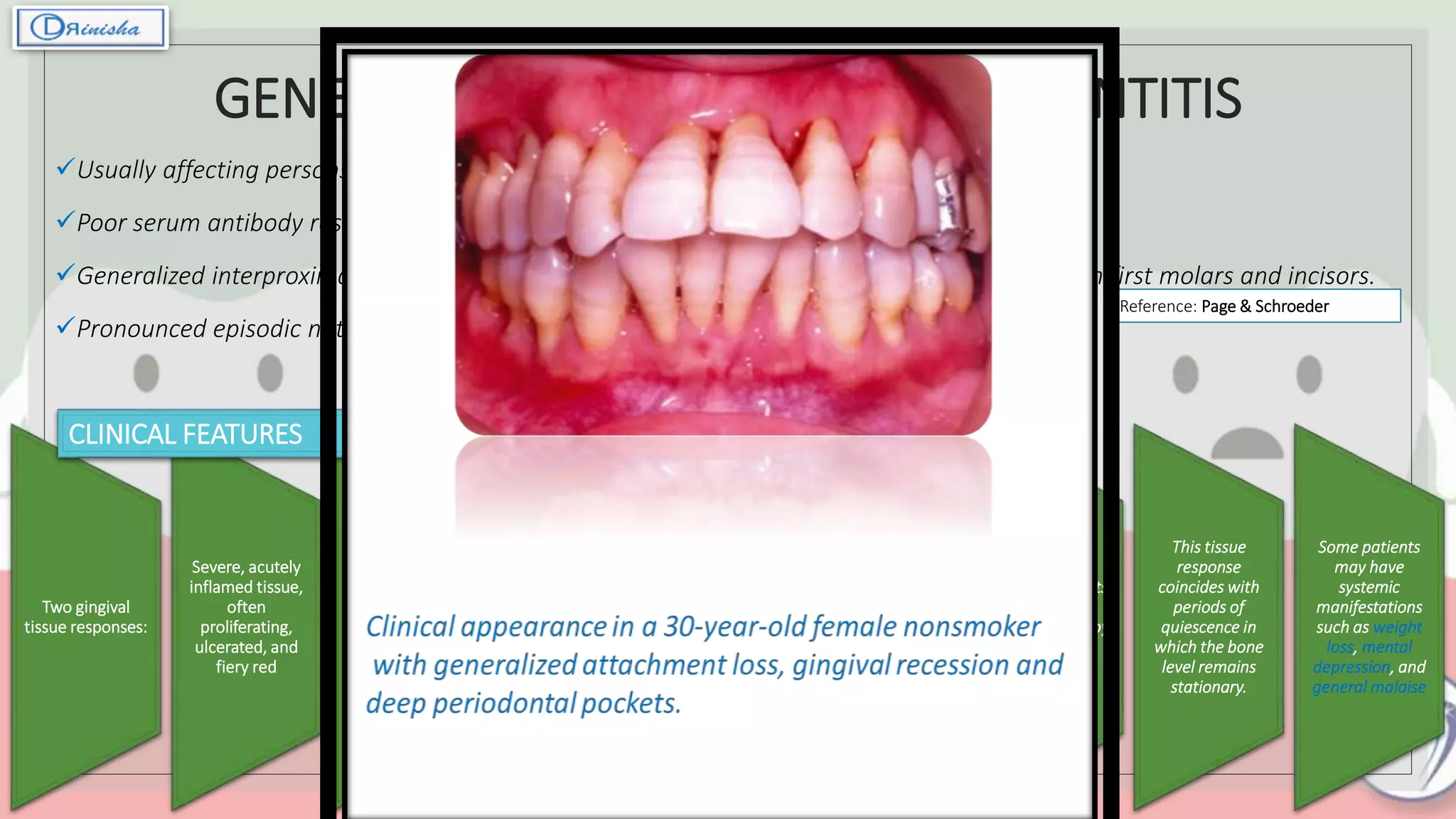 Aggressive periodontitis | PPTX