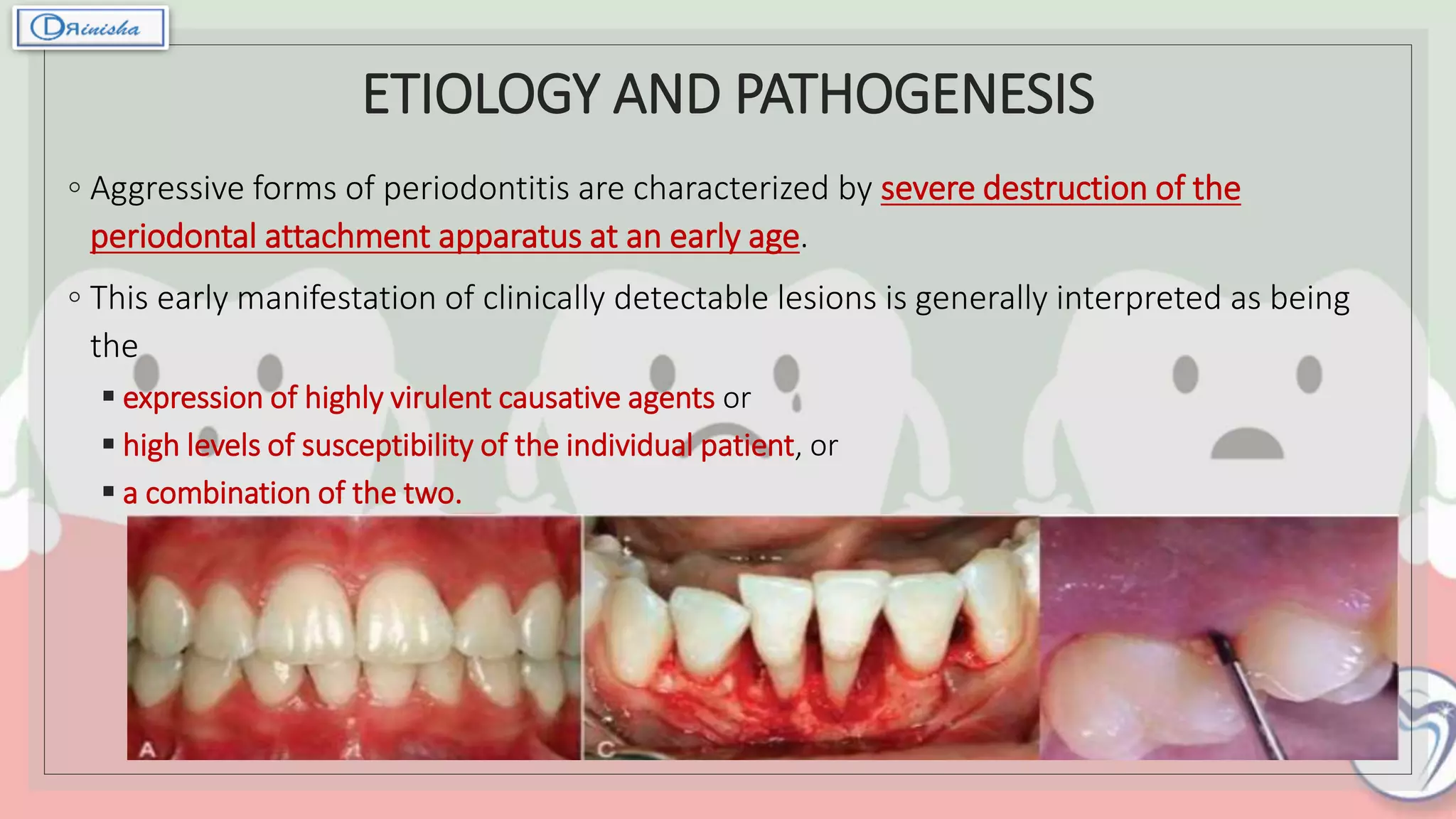 Aggressive periodontitis | PPTX