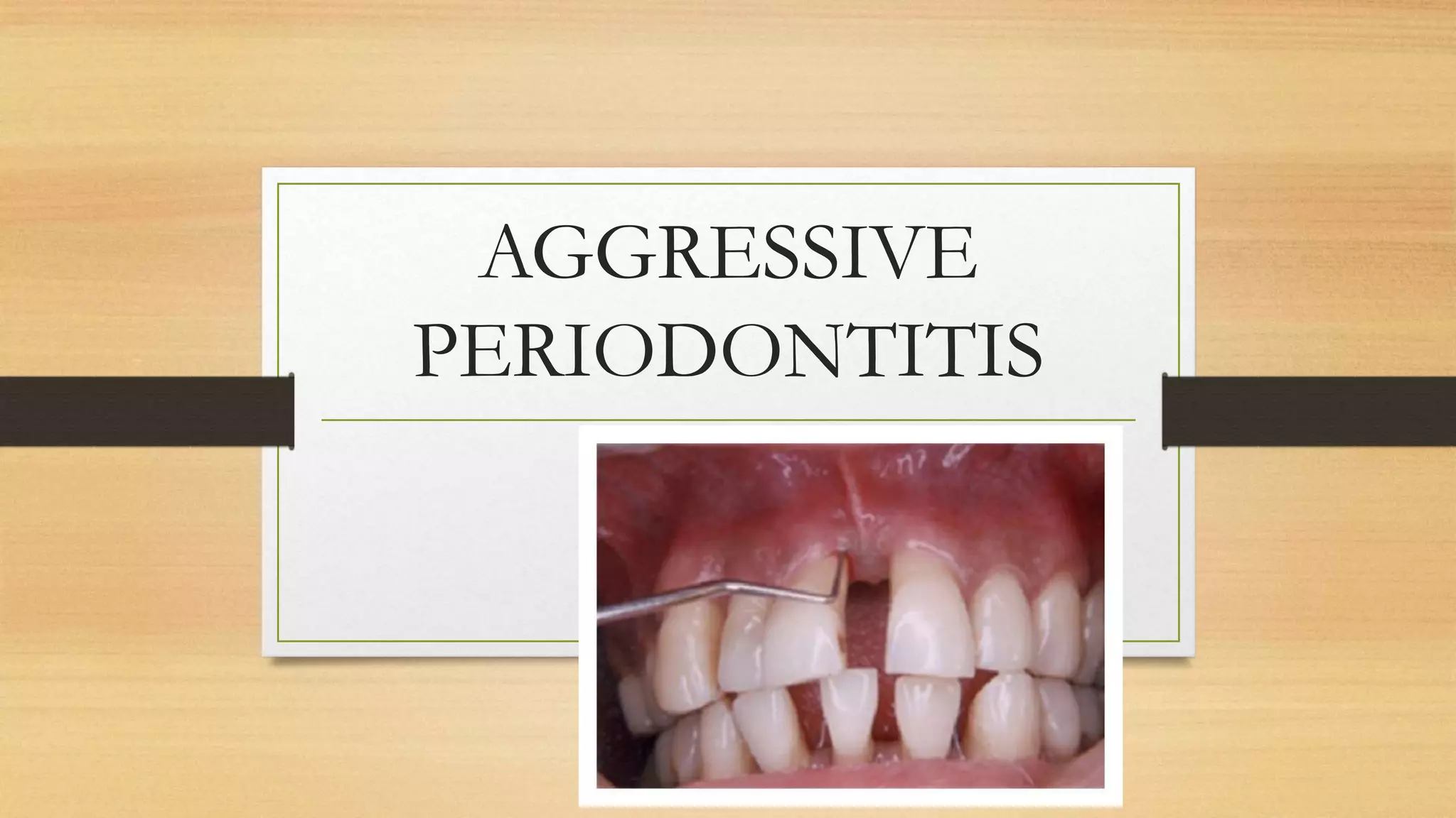 Aggressive periodontitis | PPTX