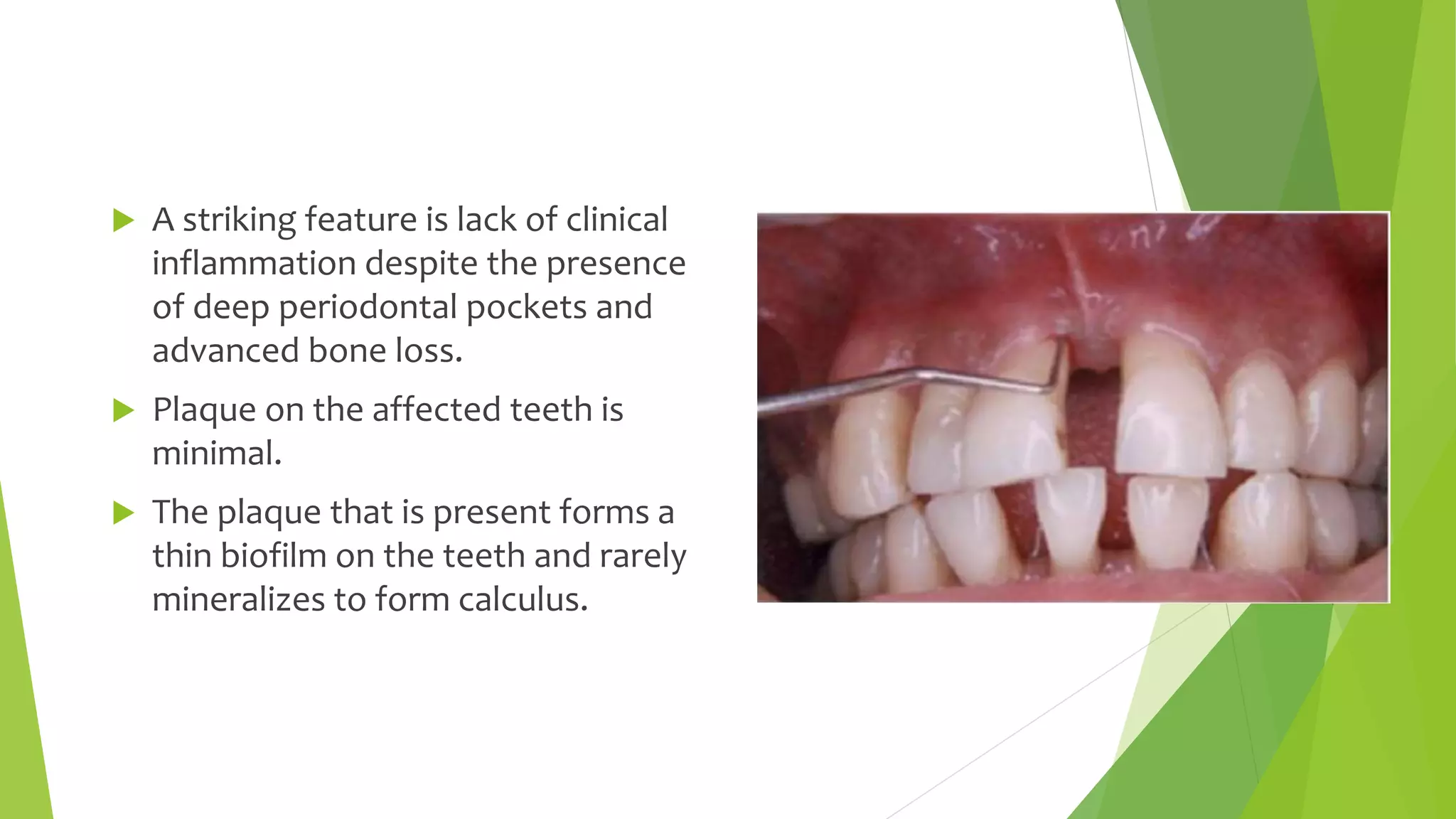 Aggressive periodontitis | PPTX