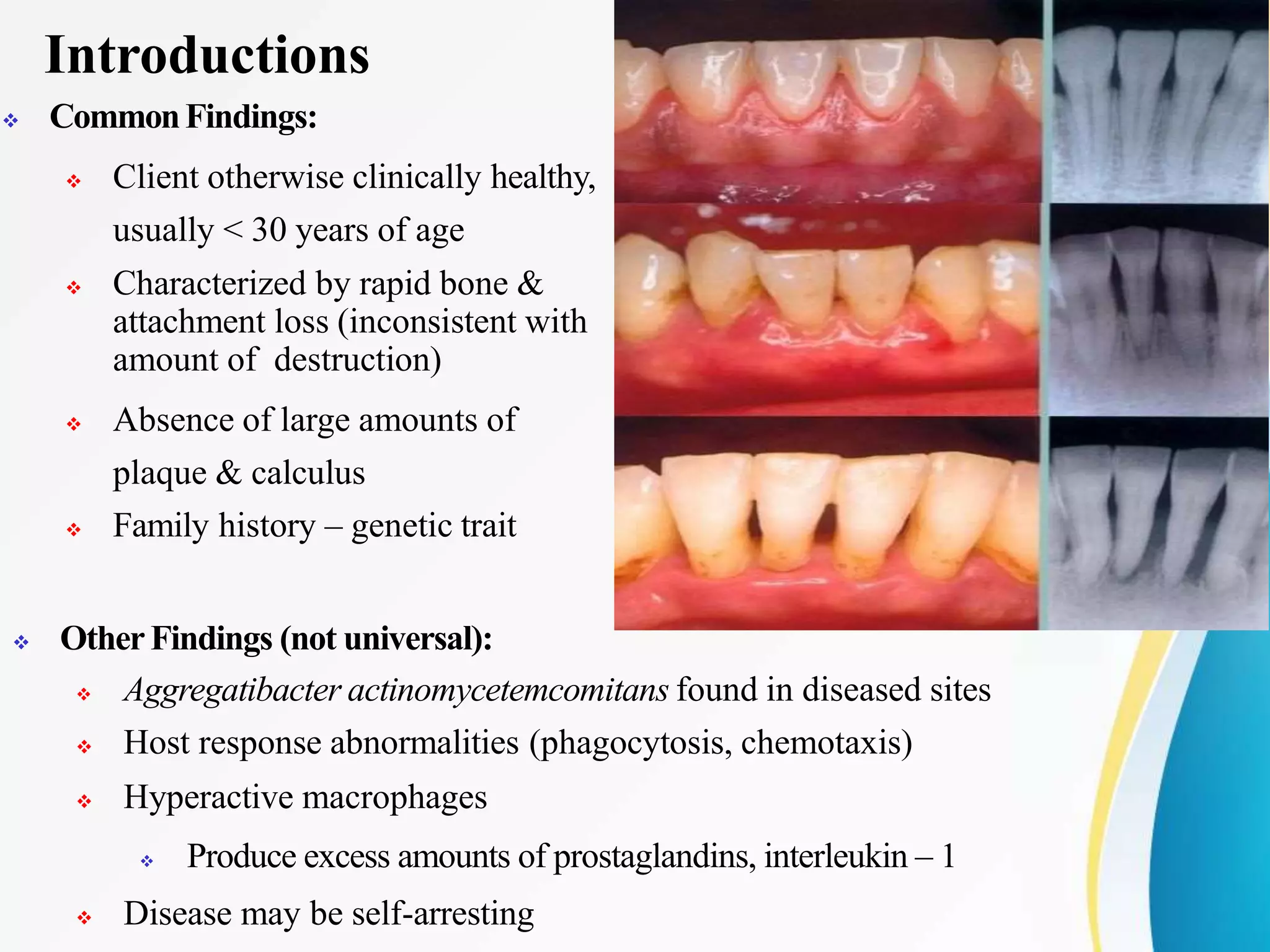 Aggressive periodontitis | PPTX