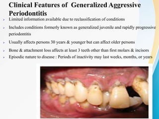 Aggressive periodontitis | PPTX