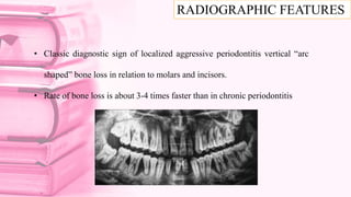 aggressive periodontitis.pptx