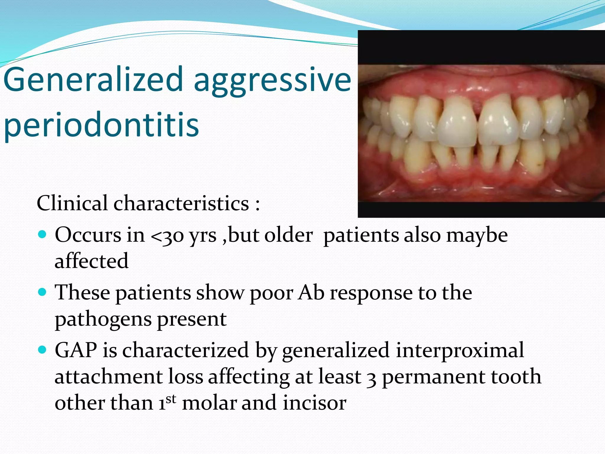 Aggressive periodontitis | PPTX