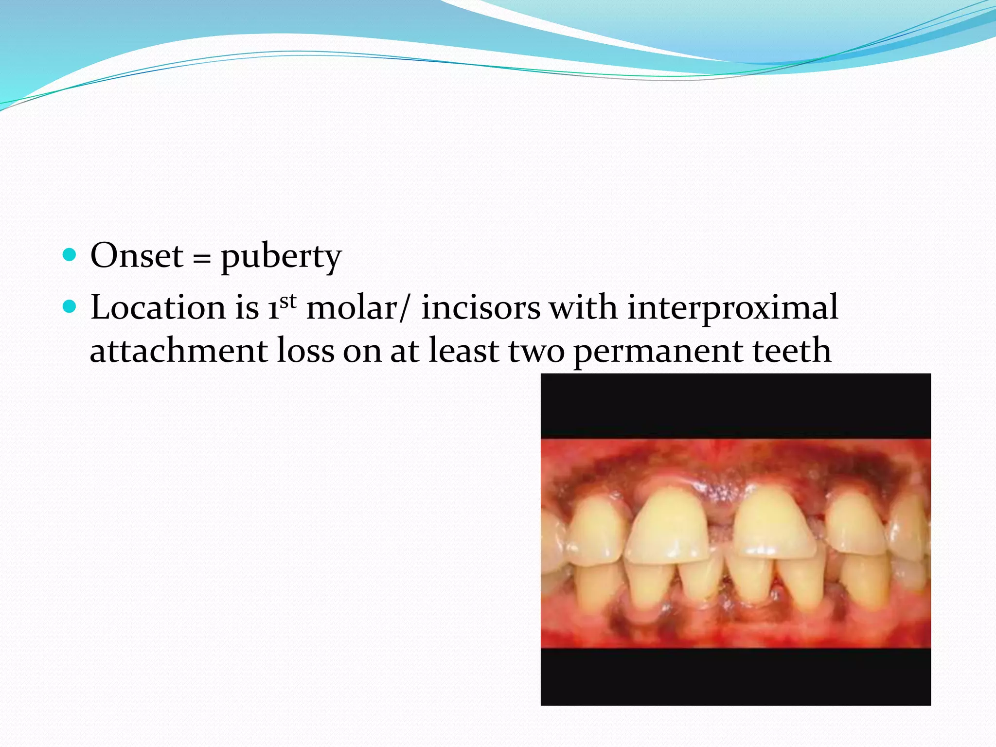Aggressive periodontitis | PPTX