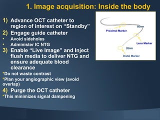 OCT - few basic facts | PPT | Heart and Cardiovascular Diseases ...