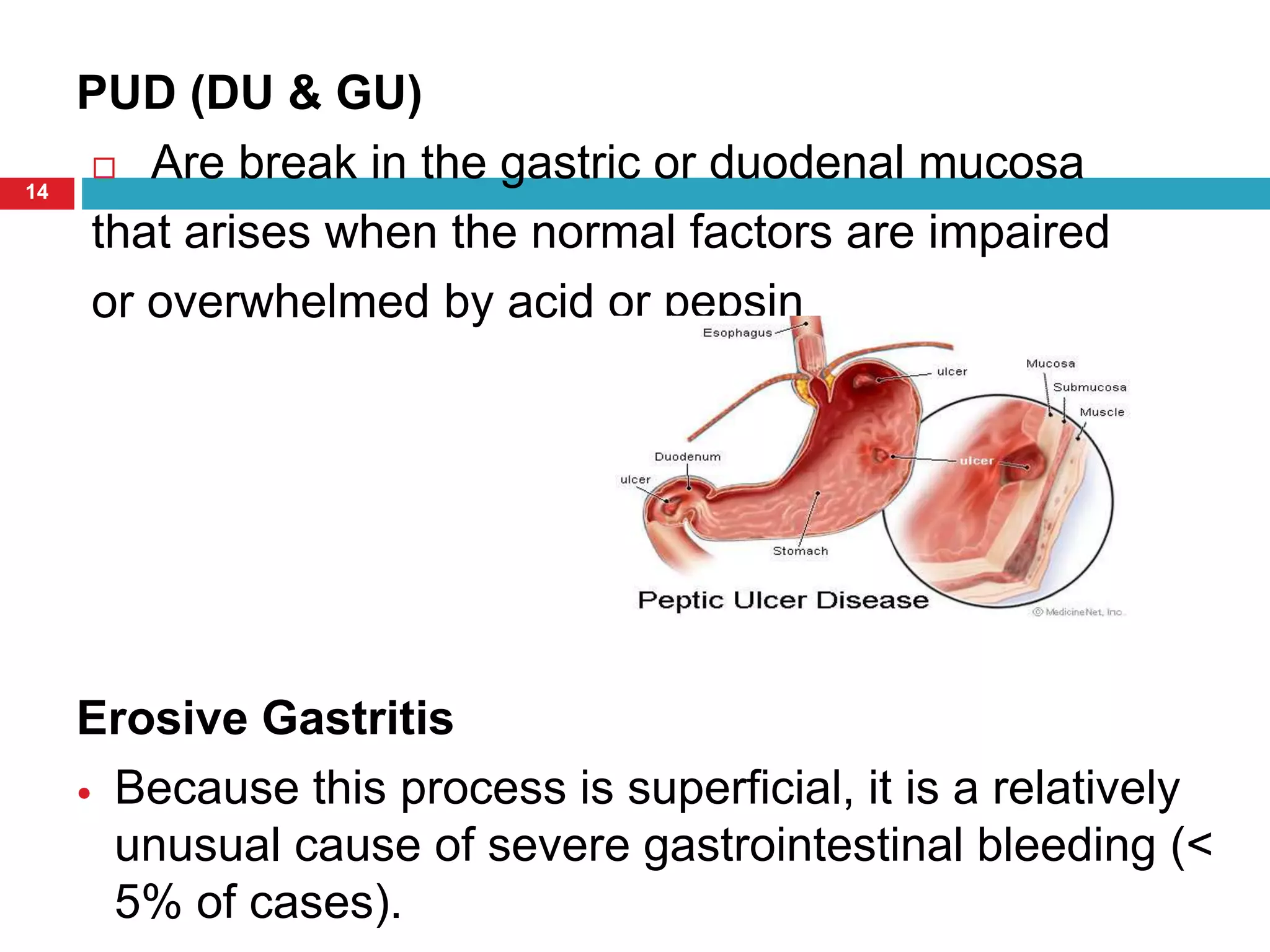 ACUTE GI BLEEDING | PPTX