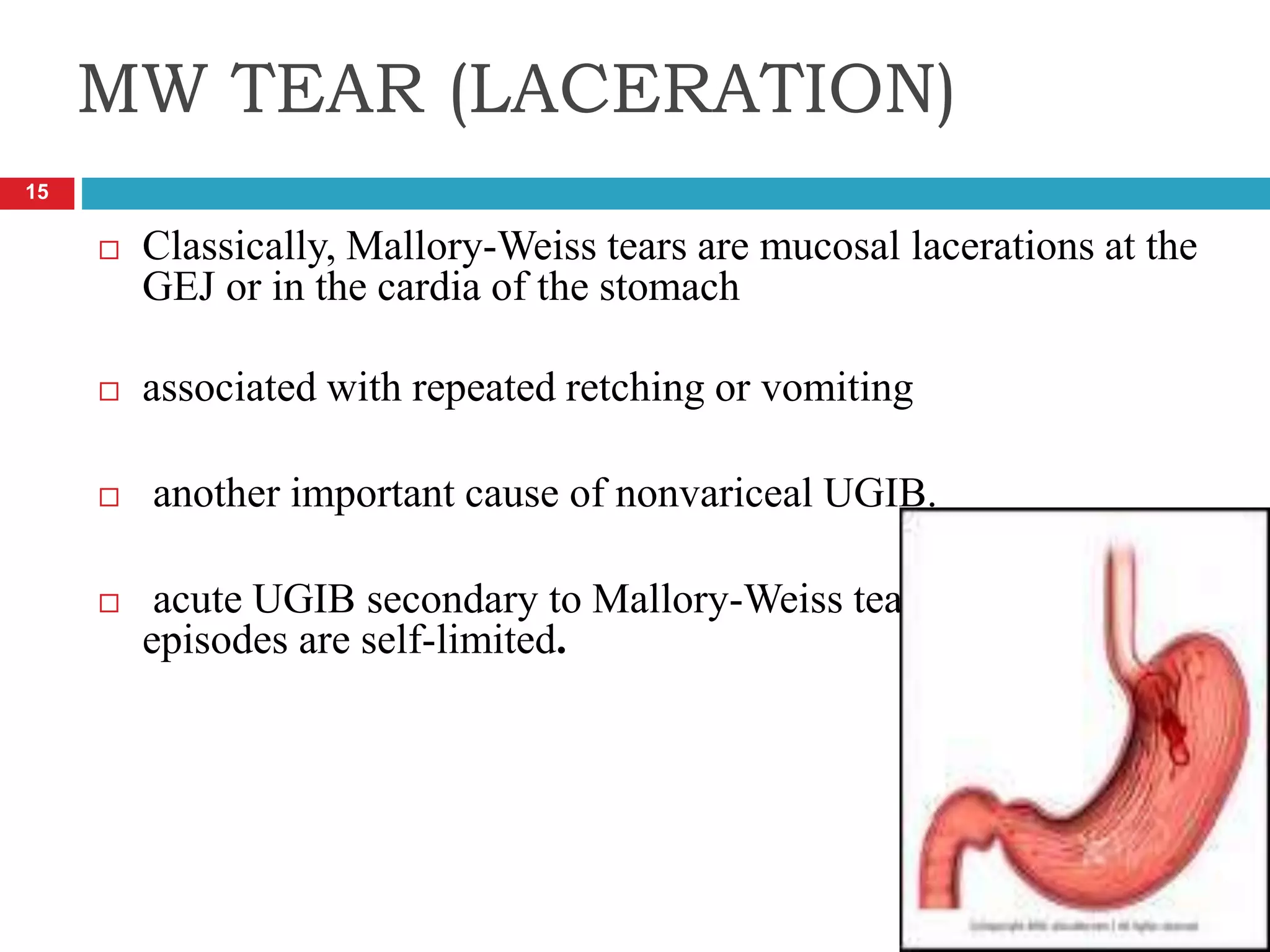 ACUTE GI BLEEDING | PPTX