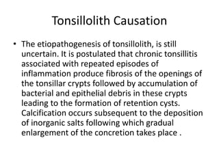 A giant tonsillolith | PPTX