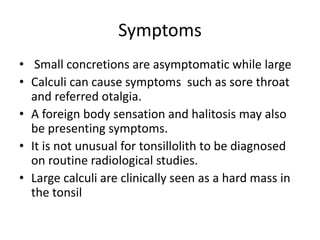A giant tonsillolith | PPTX